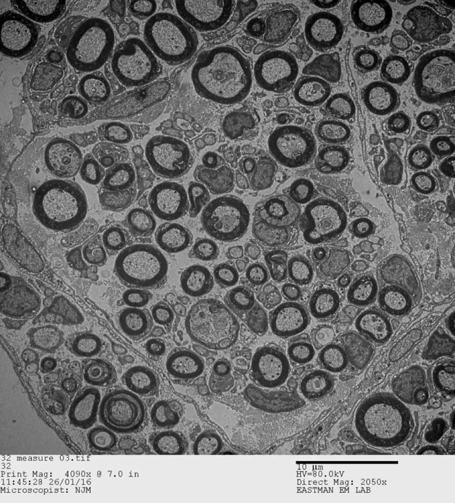 JamesScientificReportsPaper - UCL Centre for Nerve Engineering - UCL ...
